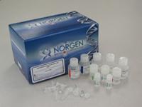RNA CleanUp and Concentration Kit – Bioquote